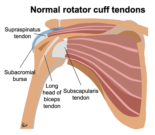 Calcific Tendonitis & Barbotage | Effective Injection Therapy