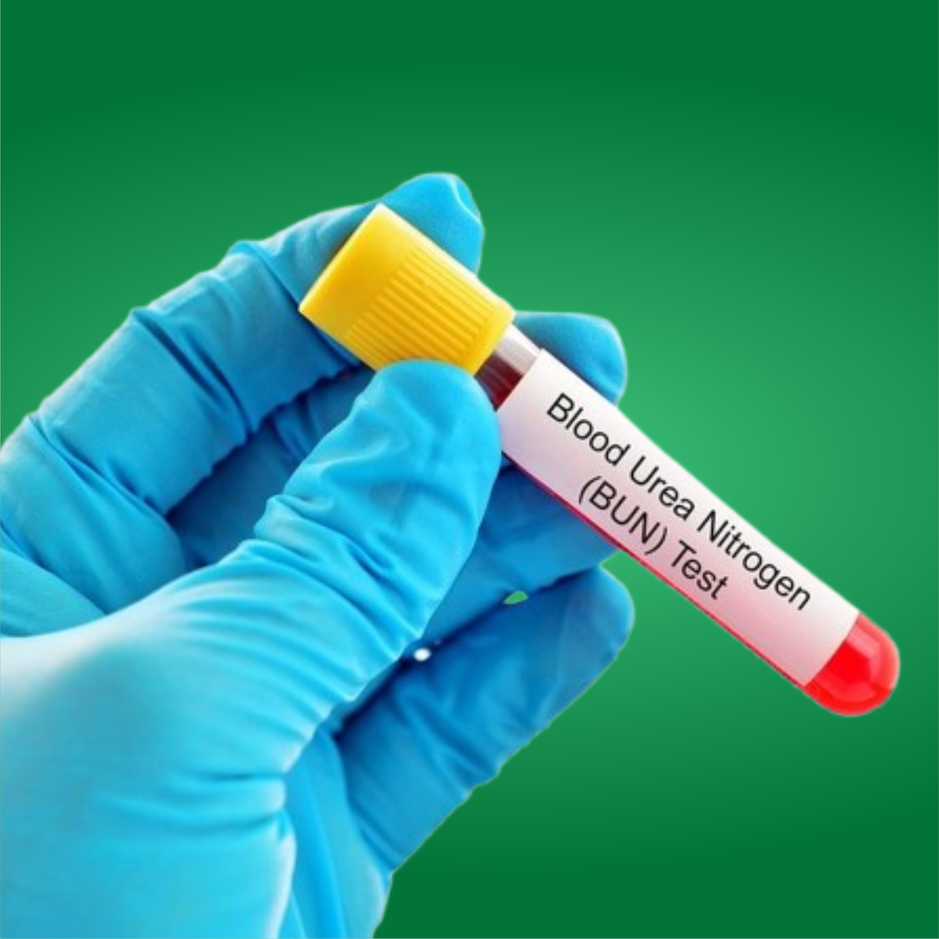 What Is Urea Nitrogen In Blood Test