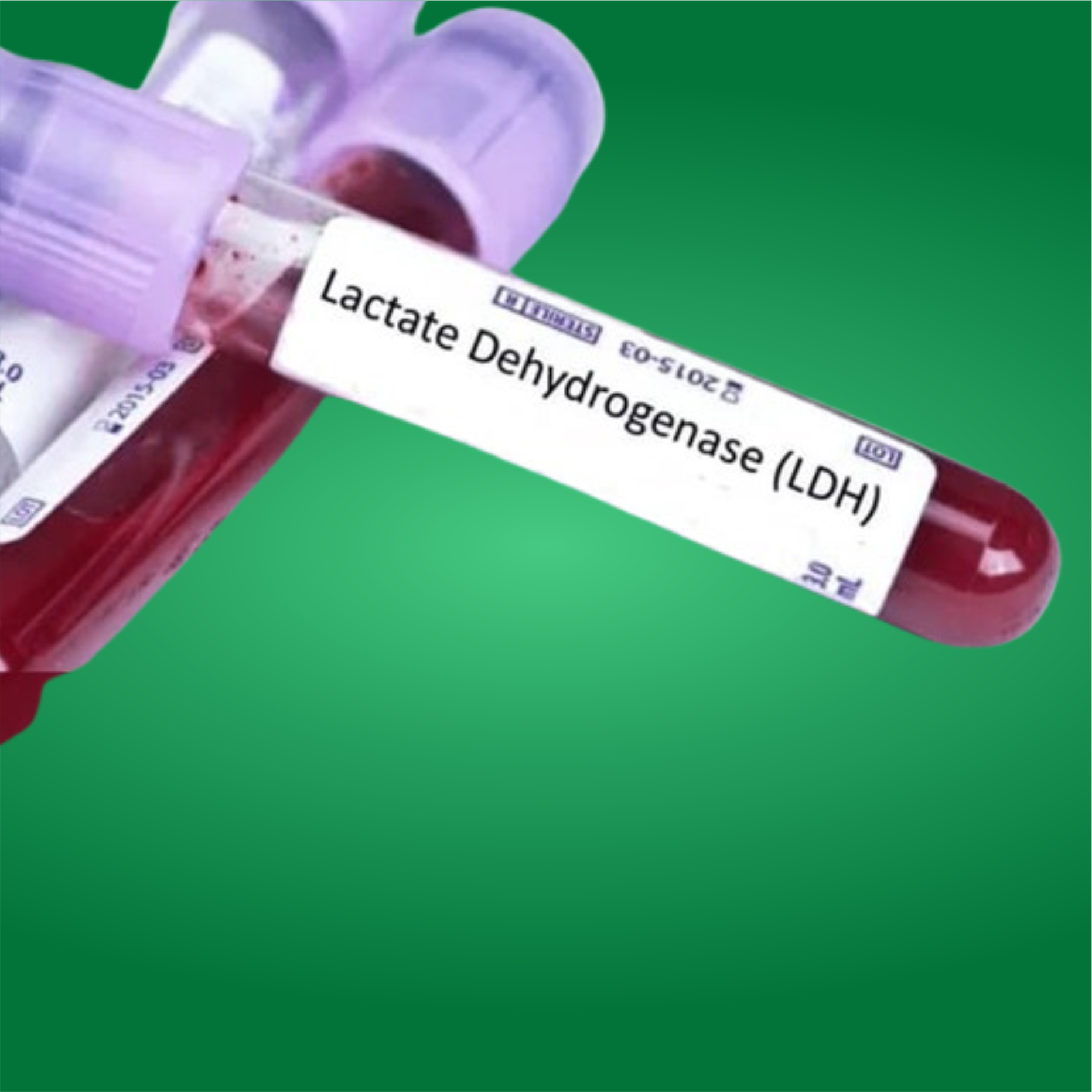 LDH Test | Sampurna care