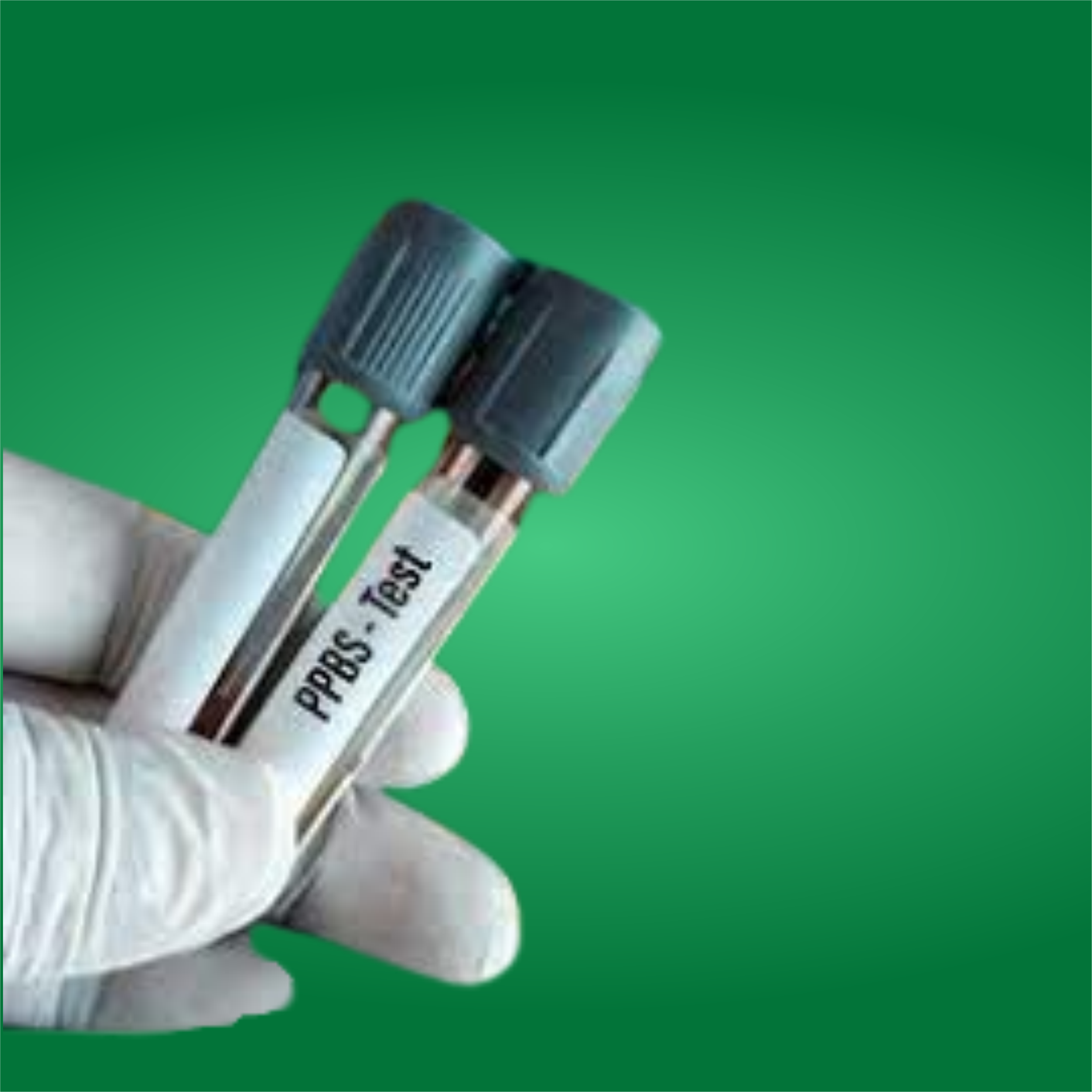 Post-Prandial Blood Sugar Test | Sampurna care