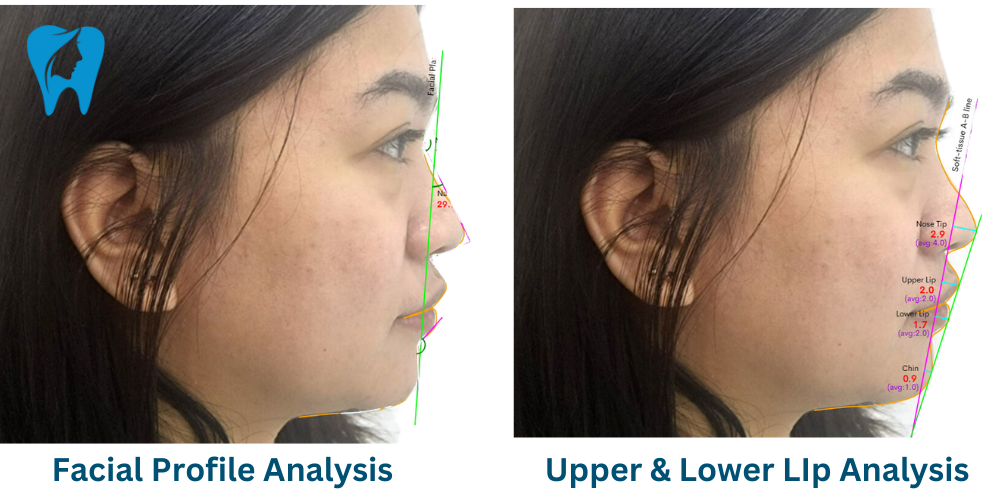 Best Orthodontist in Dubai & Sharjah I Orthodontist Near Me