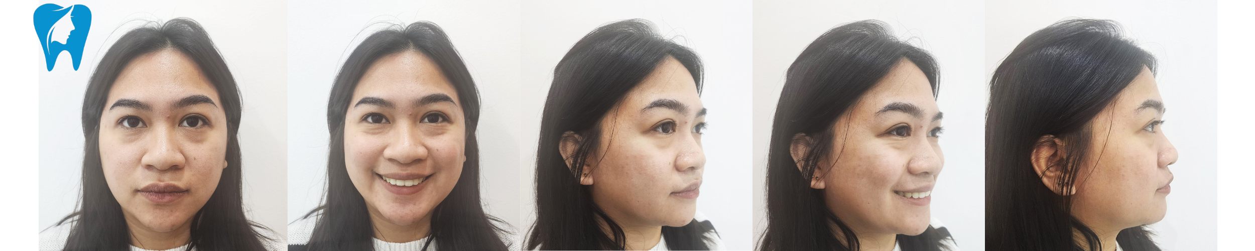 Best Orthodontist in Dubai & Sharjah I Orthodontist Near Me