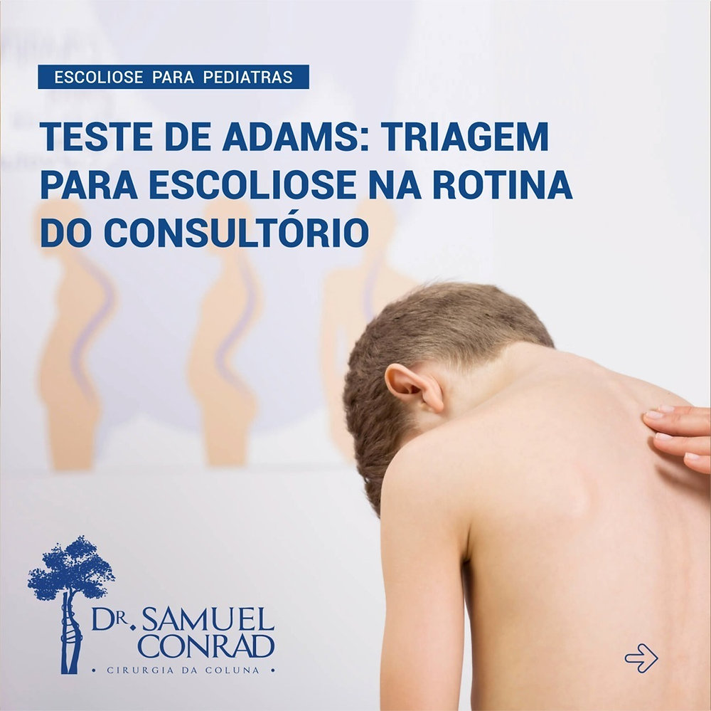 CONHEÇA O TESTE DE ADAMS