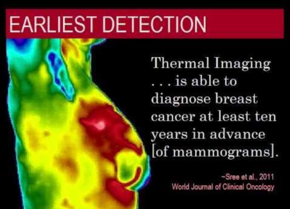 MAMMOGRAM VS. THERMOGRAM???