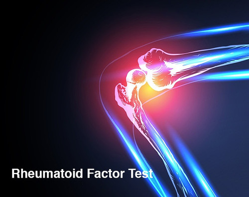 Rheumatoid Factor (RF) ( RA Test ) | sandeepmed.com