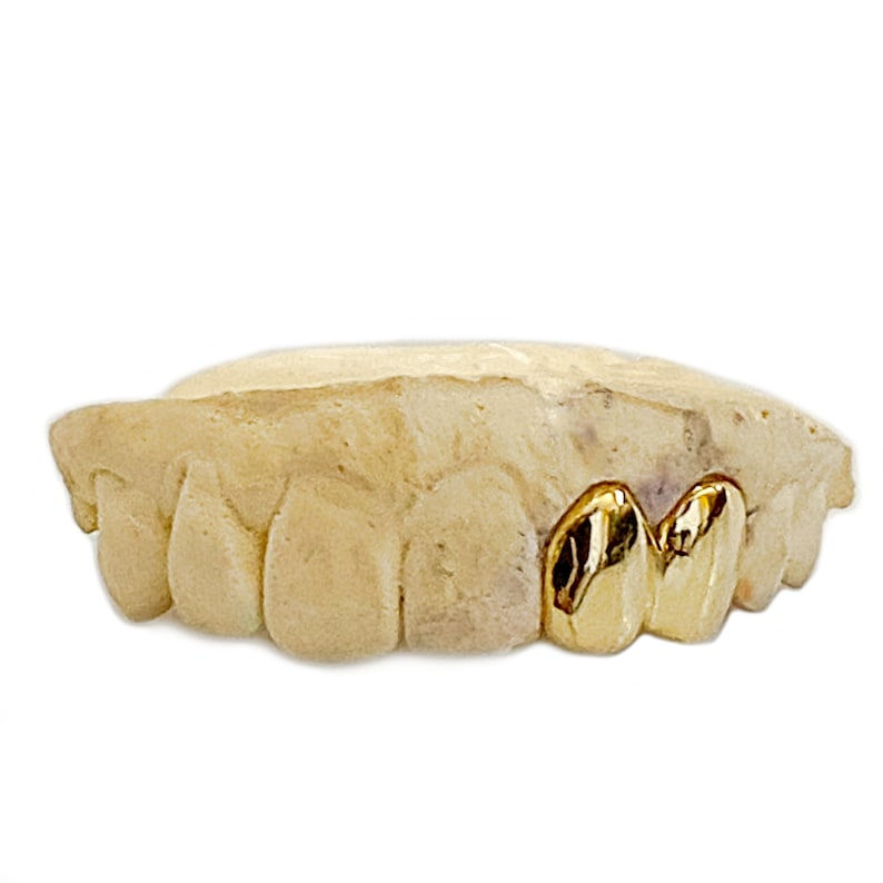 Custom 2 Piece Grillz | Essential Grillz