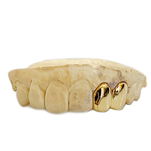 Custom 2 Piece Grillz | Essential Grillz