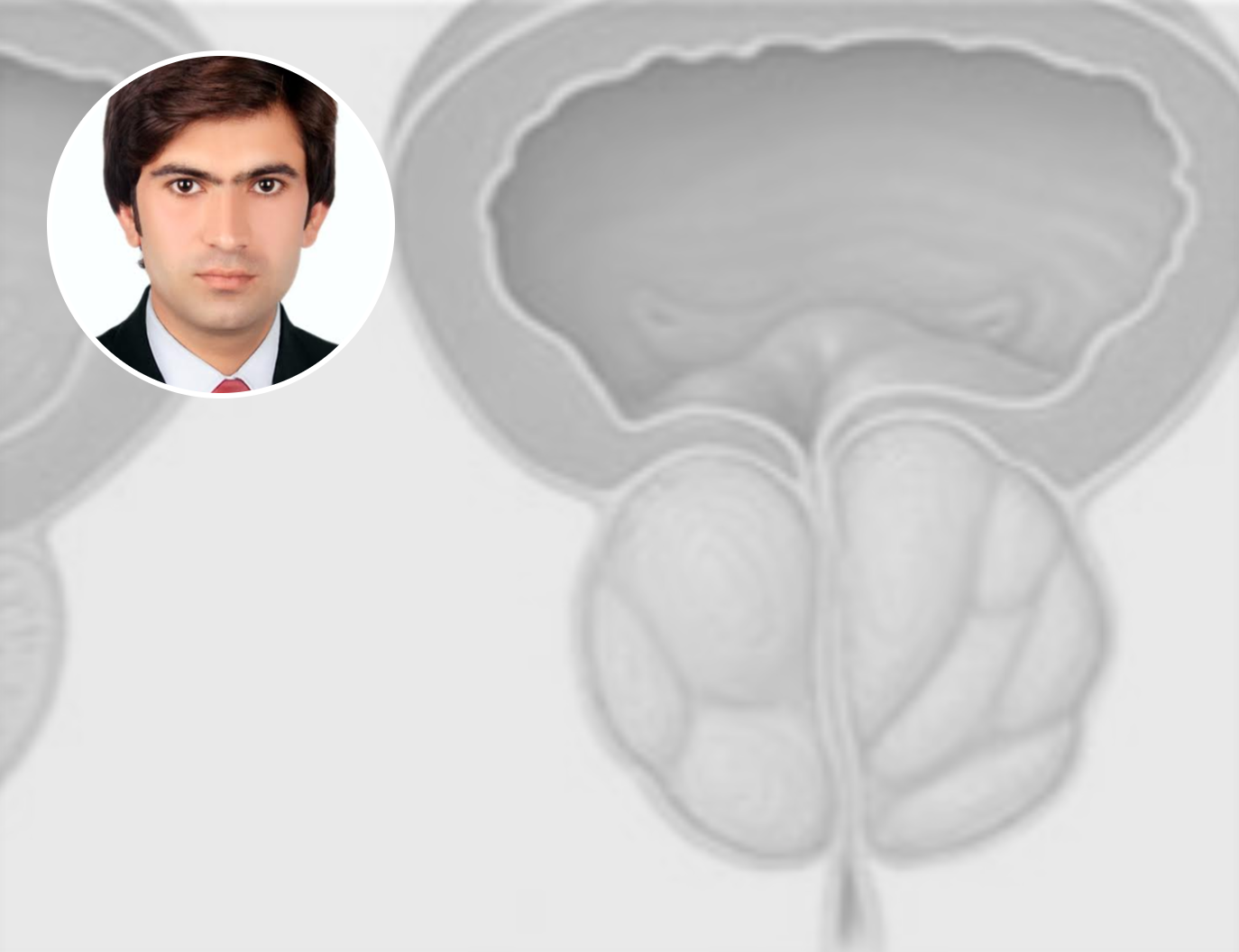 Sonographic Assessment of Bladder Outlet Obstruction in Adult Males