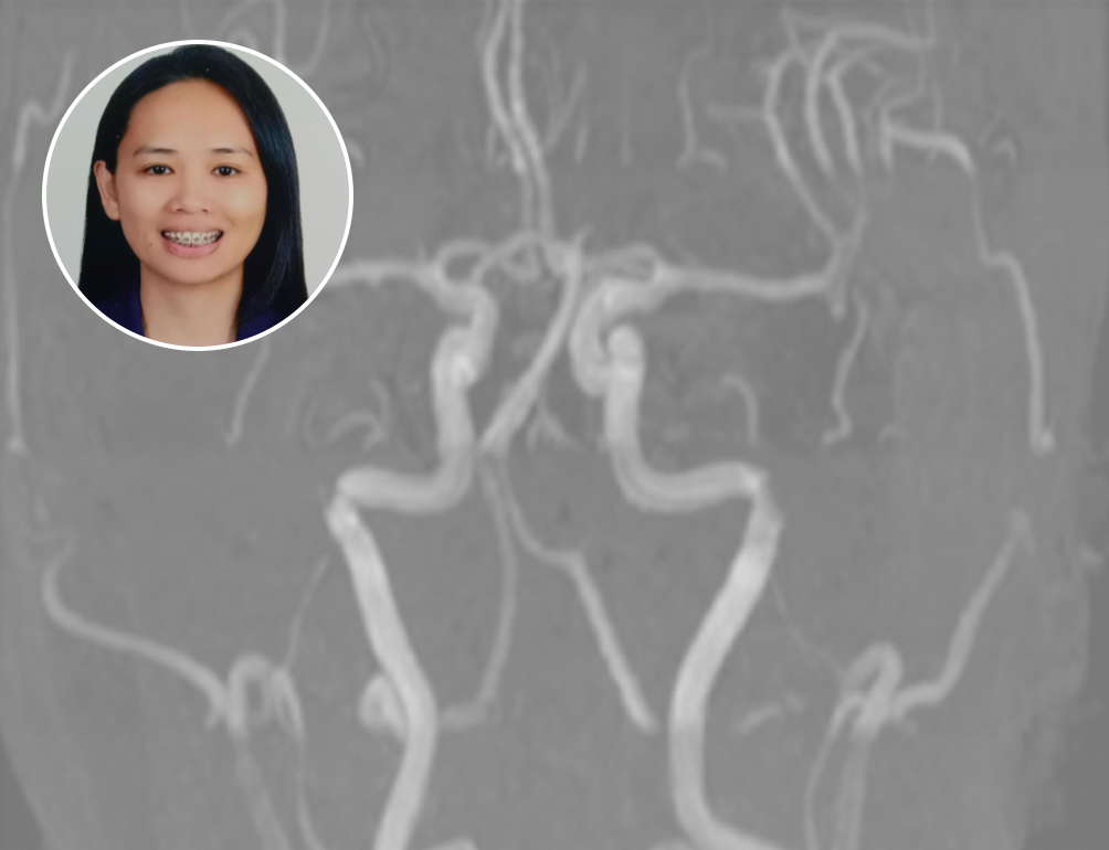 Bilateral Medial Medullary Stroke: A Single Center Case Series