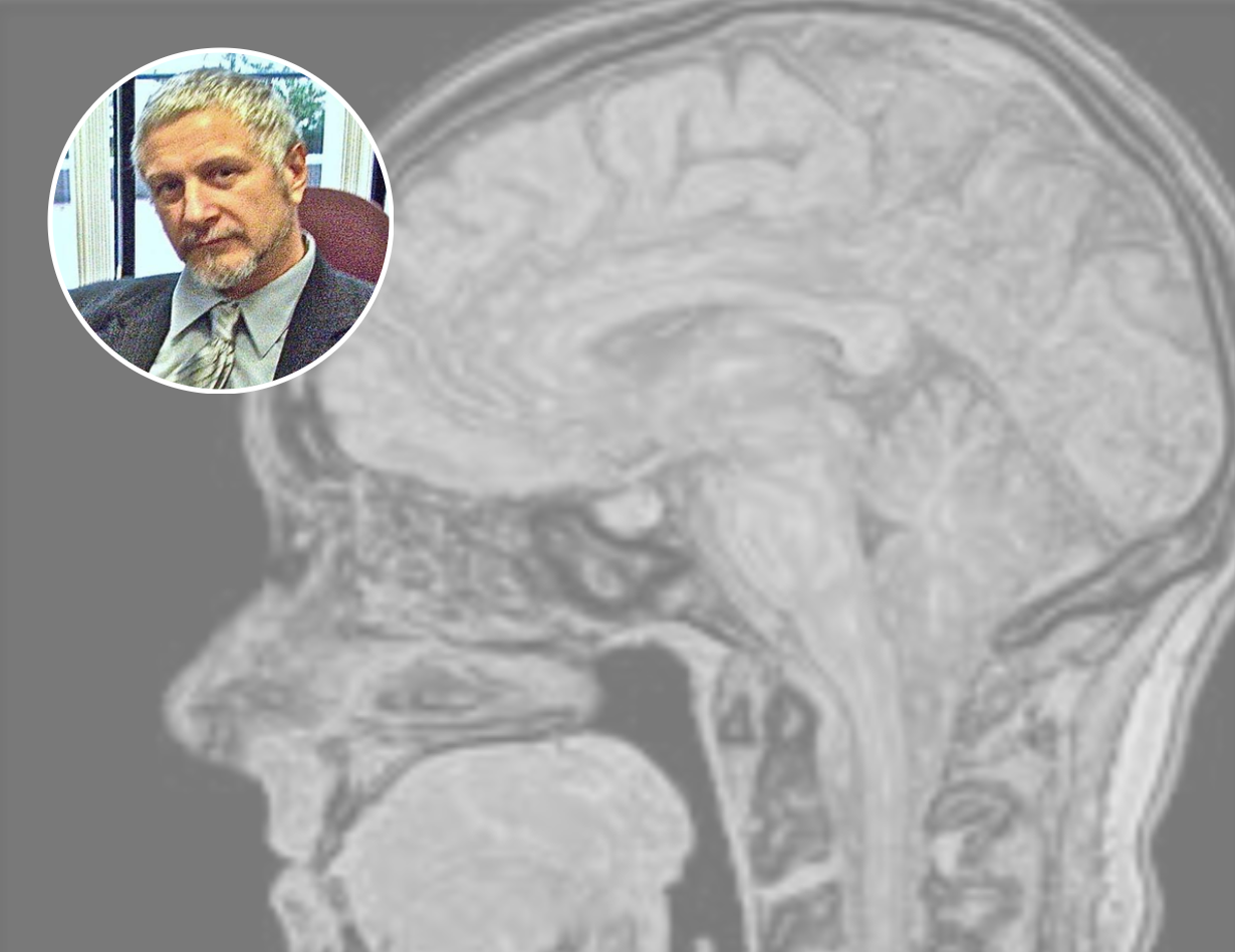 Delusional Misidentification Syndromes: Psychopathology and Culture