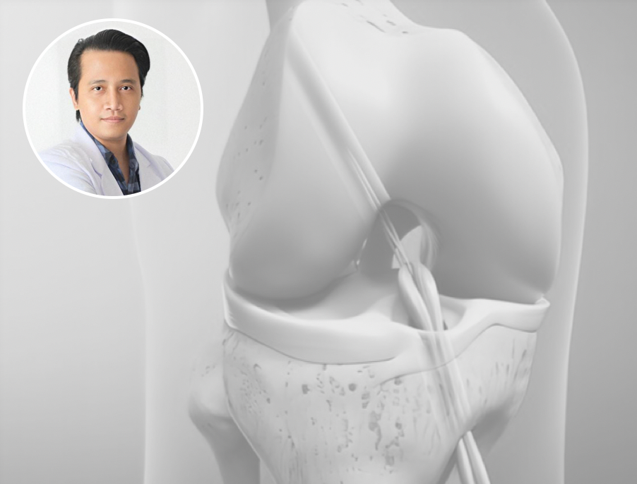 MRI Topometric of ACL Footprint on Femoral and Tibial Site in ...
