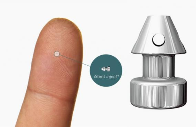 Cirurgia MIGS - iStent - para glaucoma