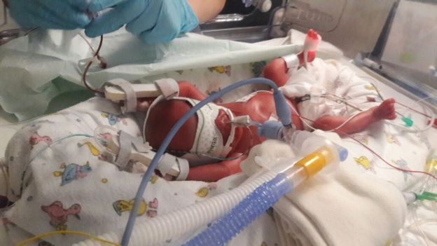 What does a NICU nurse do?