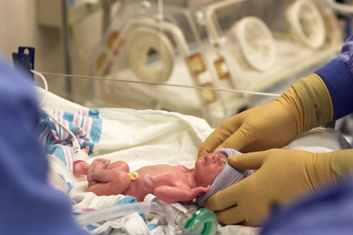 LIST OF NICU TERMS (A-Z)