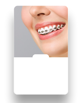 Brackets Blancos Para Adultos Amazon.com: CLT 24" White Folding Shelf