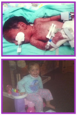 The Wall Of Our PPROM Miracle Babies | pprom-one