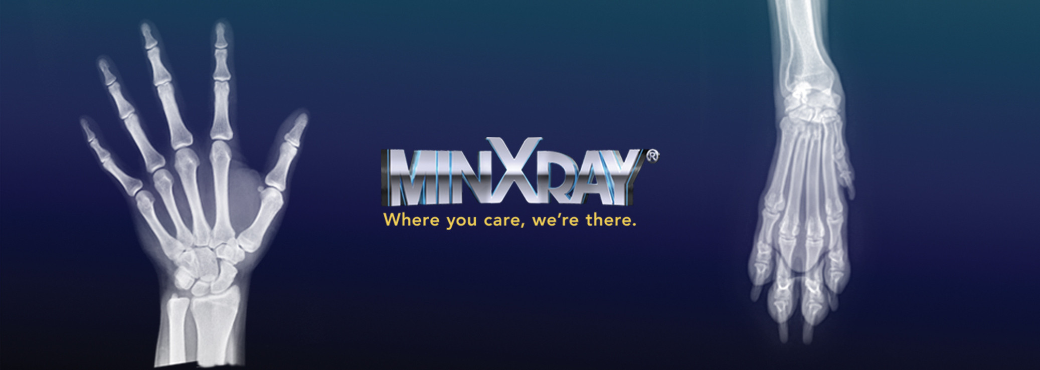 Portable X-ray Generators and Digital Radiography Systems | MinXray