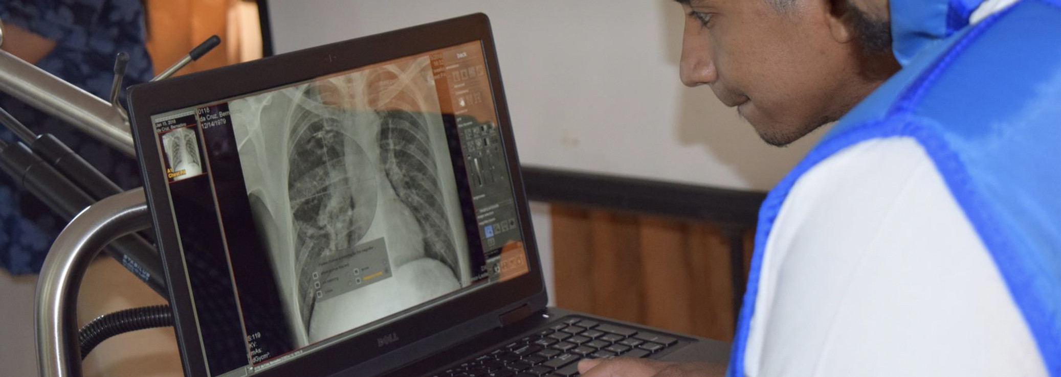 Bring X-ray Capabilities Directly to the Patient with MinXray