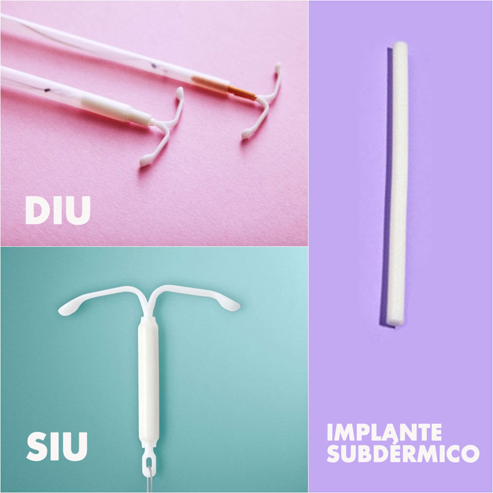 Diferencias entre el DIU y el SIU