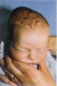 Akut bir bel ya da boyun ağrısında ne yapacağız? | Bel Fıtığı Ameliyatı ...