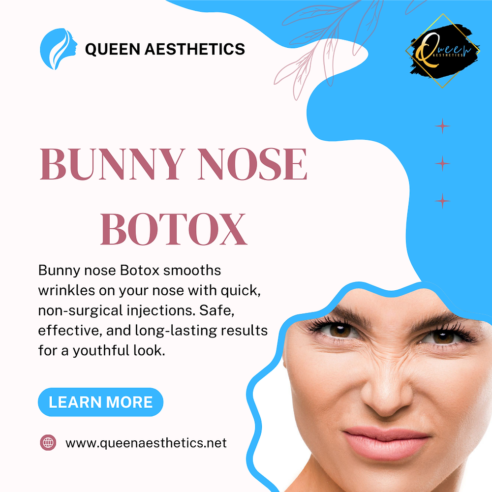 Bunny Nose Botox: Benefits, Results, and How It Works