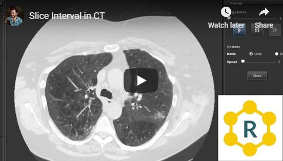 Slice Thickness and Interval Explained