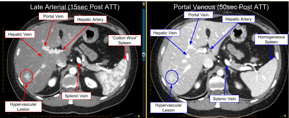 The Multiphase Liver