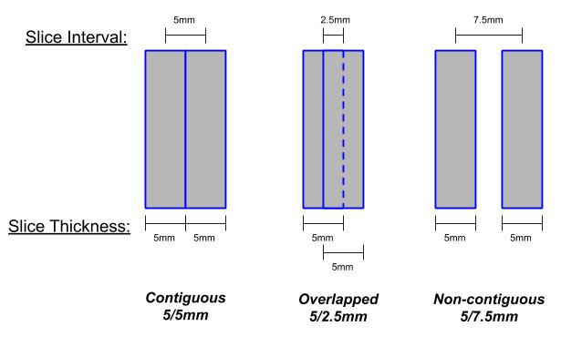 Slice Thickness and Interval Explained
