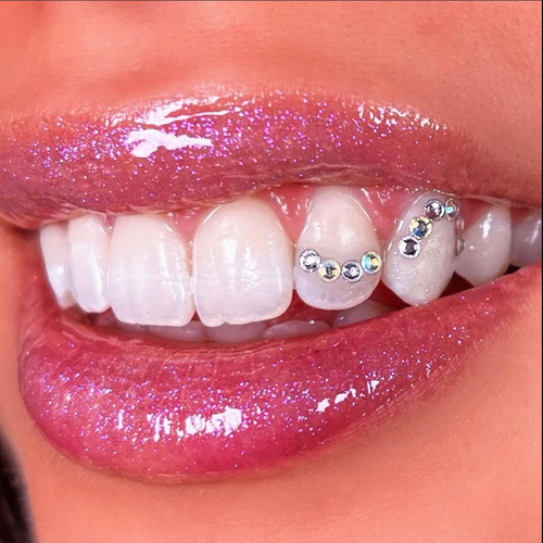 Sssmile Gemz Set | TheGemTrap