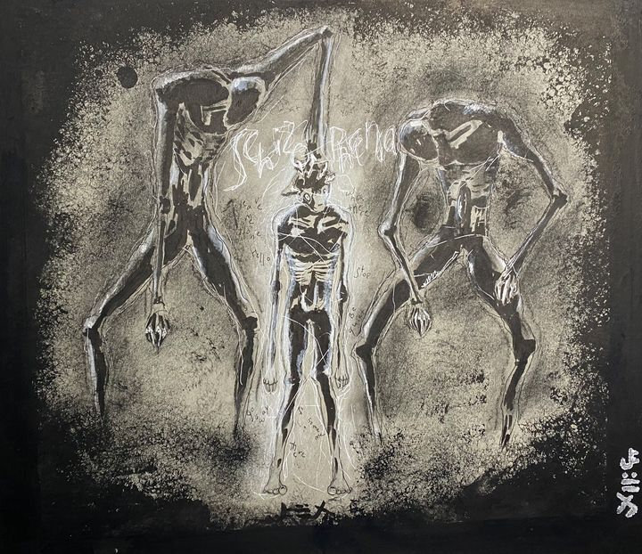 Navigating the Schizophrenia Spectrum: Understanding Disorders ...