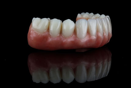 All-On-X Definitive Bridge | HTDental Prosthetics