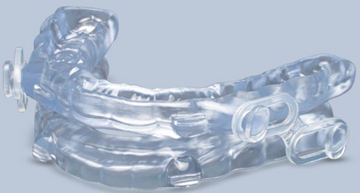 Revolutionizing Sleep Apnea Treatment with 3D Printing Revolutionizing Sleep Apnea Treatment with 3D Printing