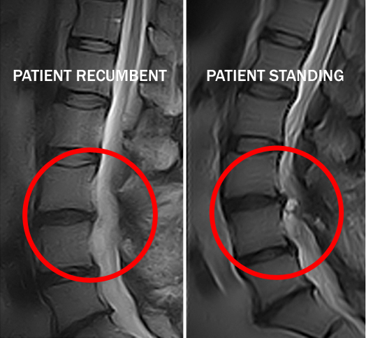 Portal Medical Group | ACR Products | Weight Bearing MRI