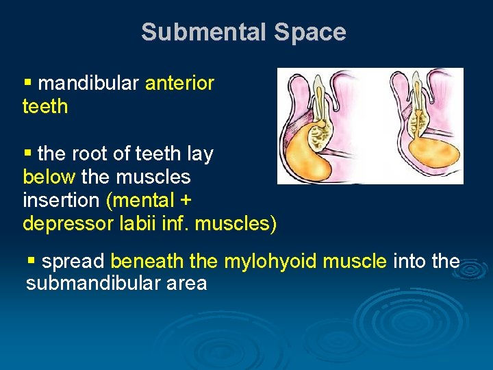 심부경부감염, 턱밑샘 구획, submandibular space - 동대문구 답십리, 마장동, 우리안애 우리안愛 내과