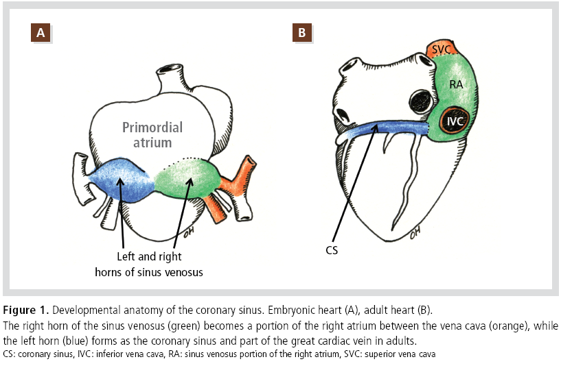 관정맥동 (coronary sinus) 보다는 쿠마딘 능선 (coumadin ridge), 좌심방 내부에