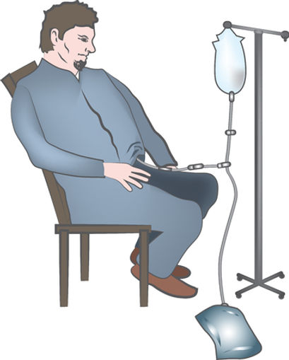 Periton Diyalizi Nedir?