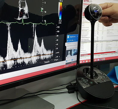 BASIC ECHO COURSE FOR SONOGRAPHERS | ECHOLAB.PH