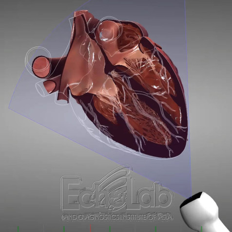 Echocardiography Laboratory and Diagnostics Institute of Asia, Inc | 2d ...