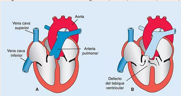 Malformaciones congénitas | Atlas Embriologia2