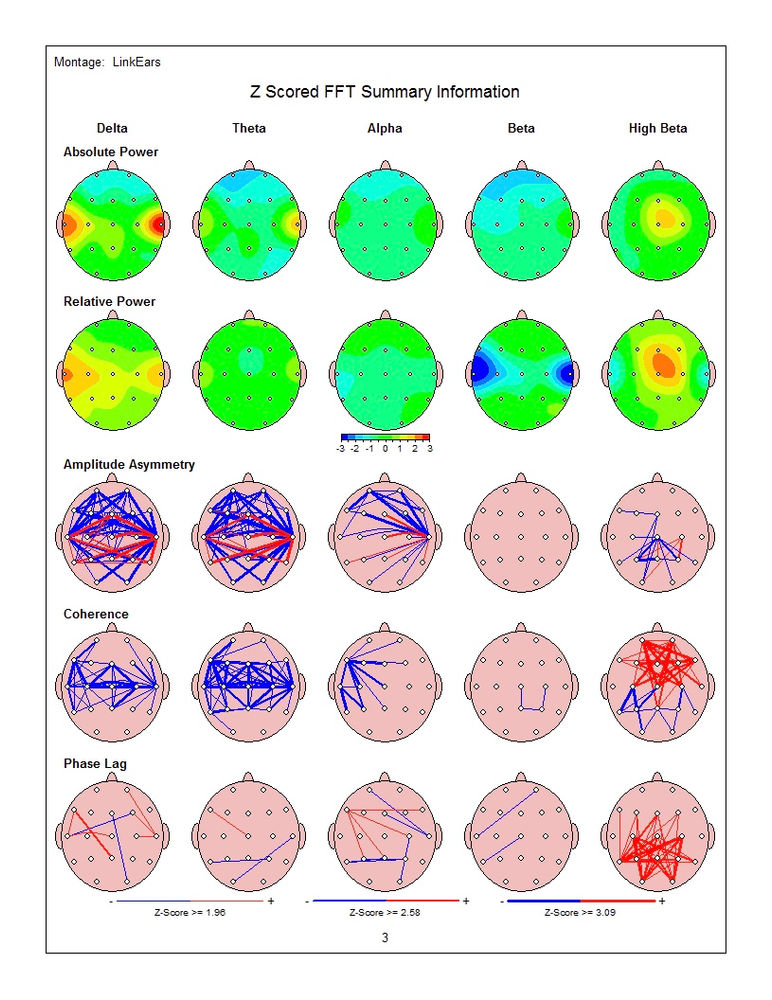 QEEG Brain Mapping: What to Expect and Preparation Checklist
