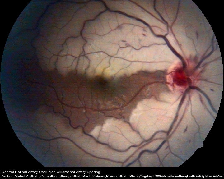 O que é a Retinografia?