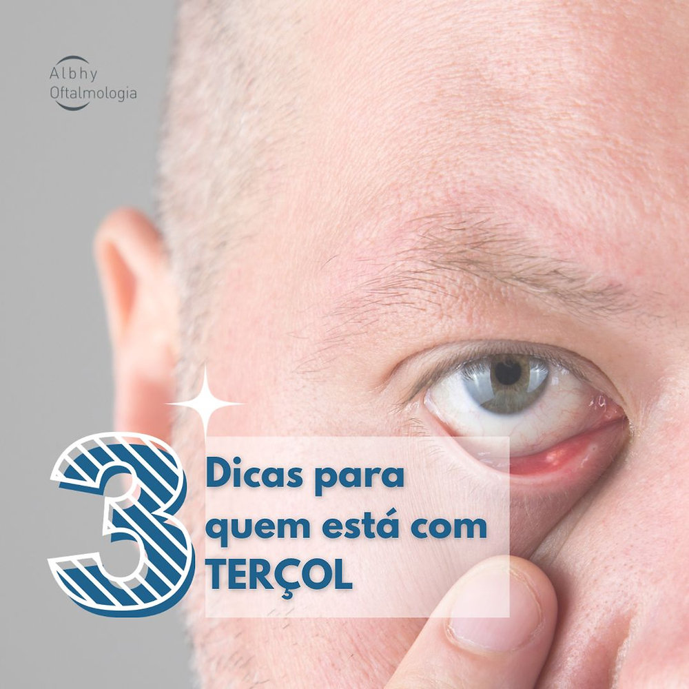 3 dicas para quem está com TERÇOL