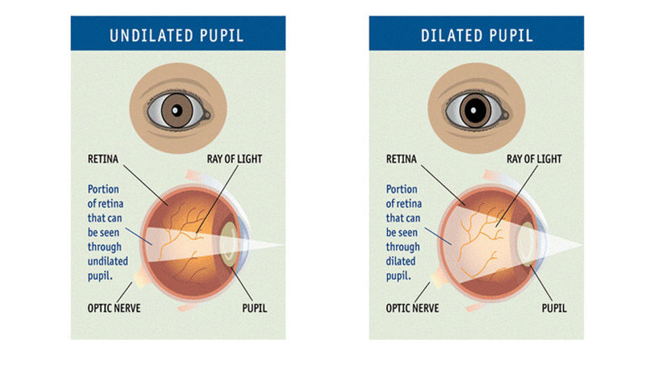 The importance of pupil dilation at an eye exam and why we do them.
