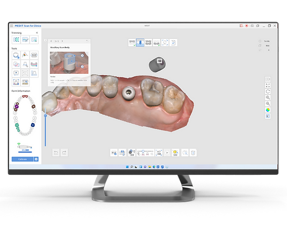 Digital Dentistry | Medit Link Dental Platform