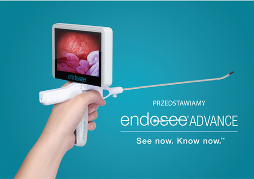 ENDOSEE Advance ręczny histeroskop (indywidualna wycena) | Rovers ...