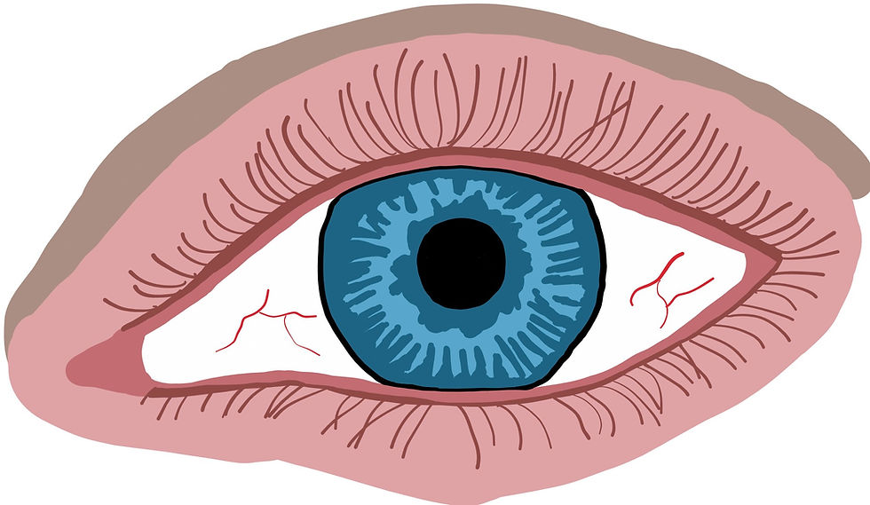 Preseptal Cellulitis vs Orbital Cellulitis