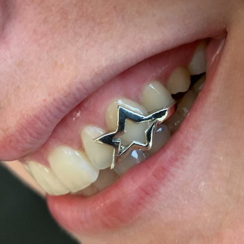 Open-faced 3-Tooth Star Grill | The Plug Jewelry & Gold teeth