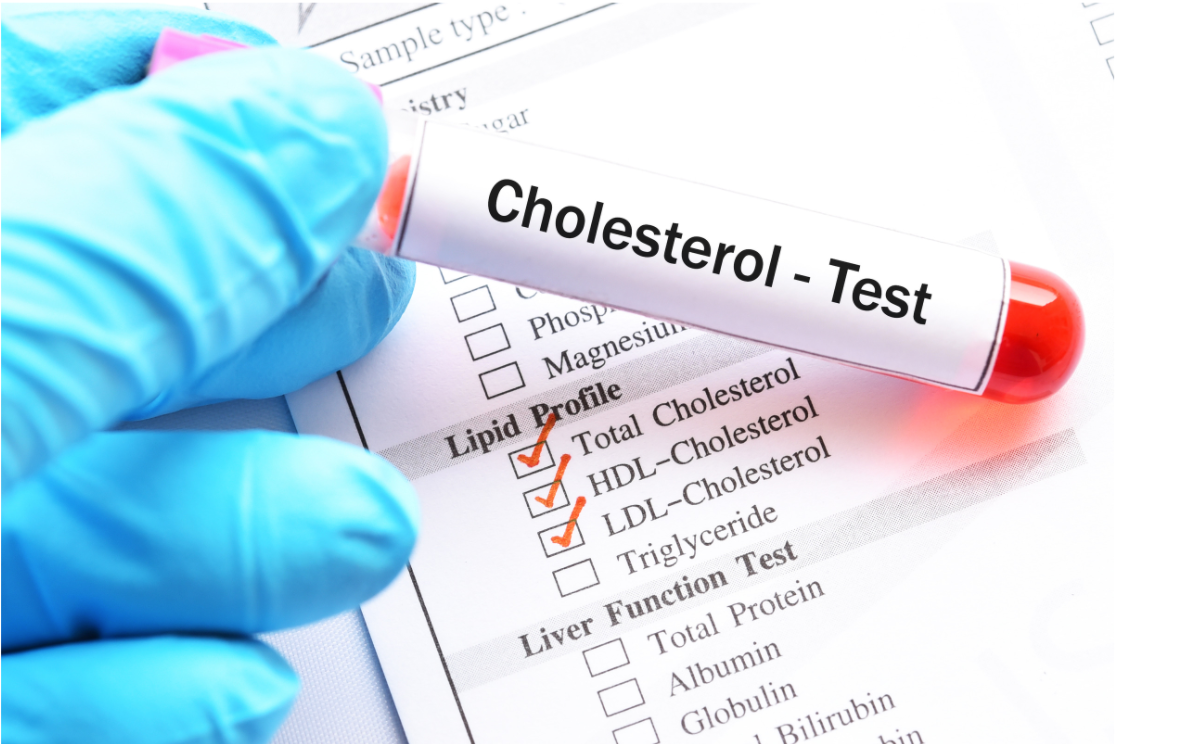 Monitoring Your Cholesterol Levels
