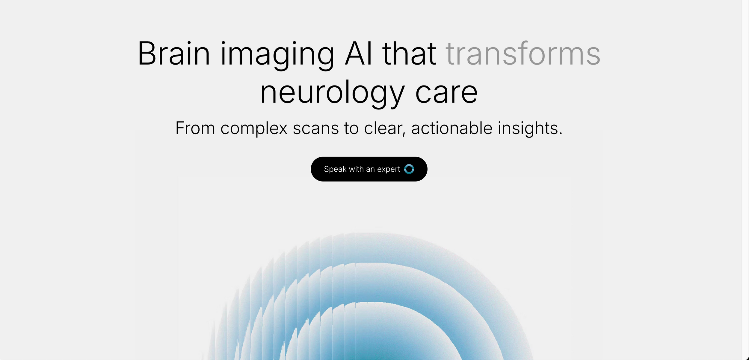 icobrain ms | icometrix