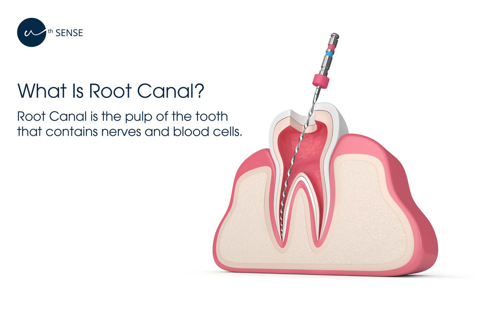 Microscopic Root Canal | Oral Care | Dr. Suvidh Virmani